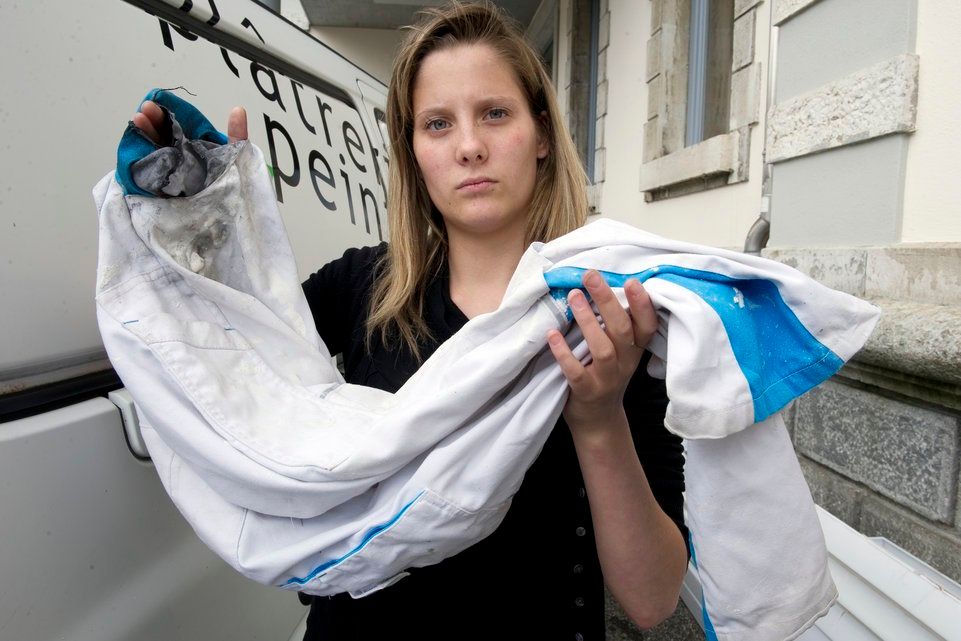 Remember The Girl With A Third-Degree Burn From A Galaxy S3? Samsung's ...