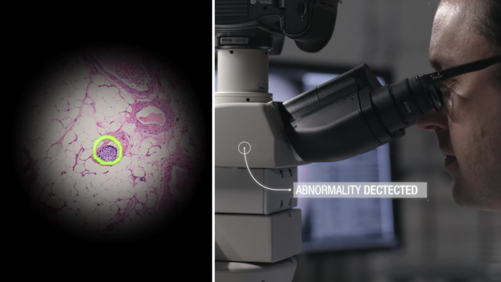 Google announces Augmented Reality Microscope platform to aid in cancer ...