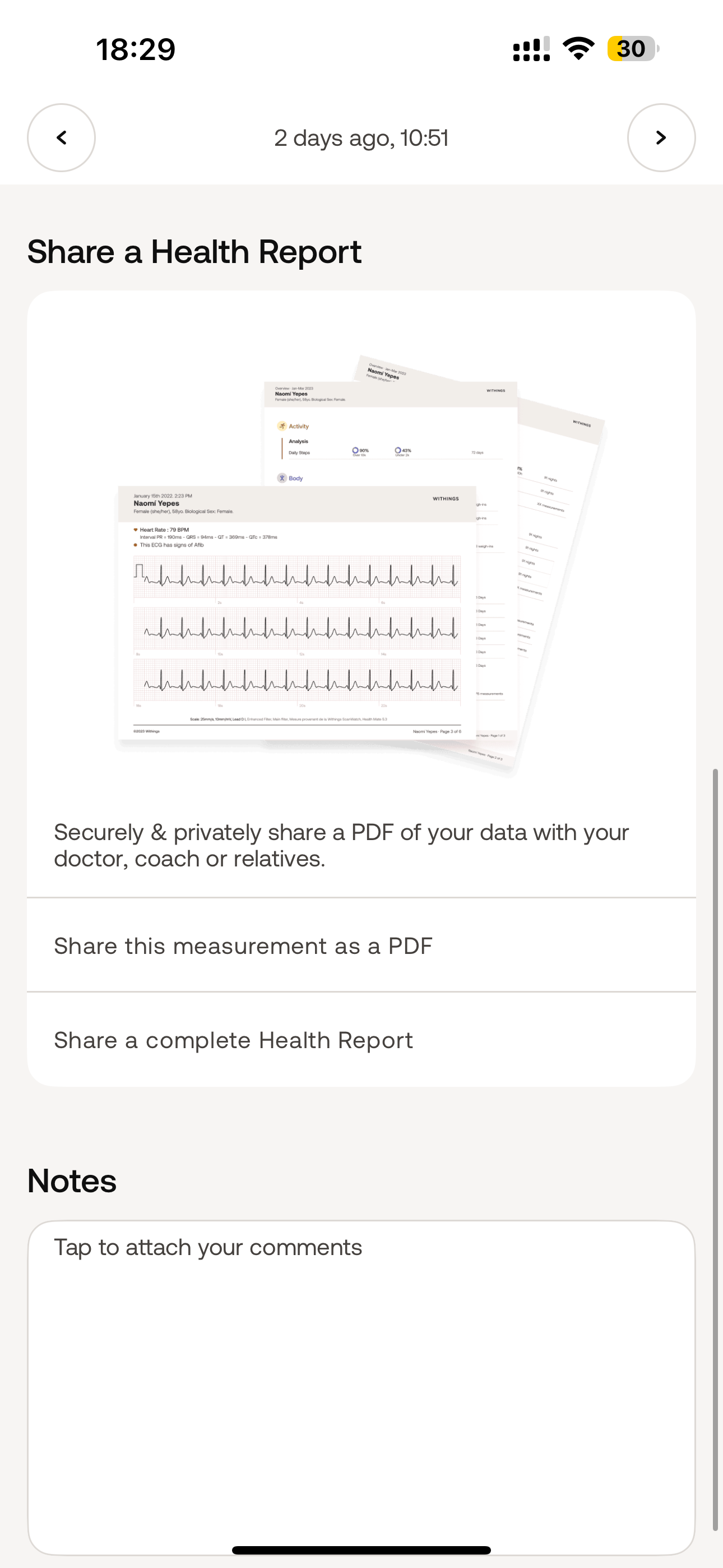Withings Body Scan review: Professional measurements for personal use